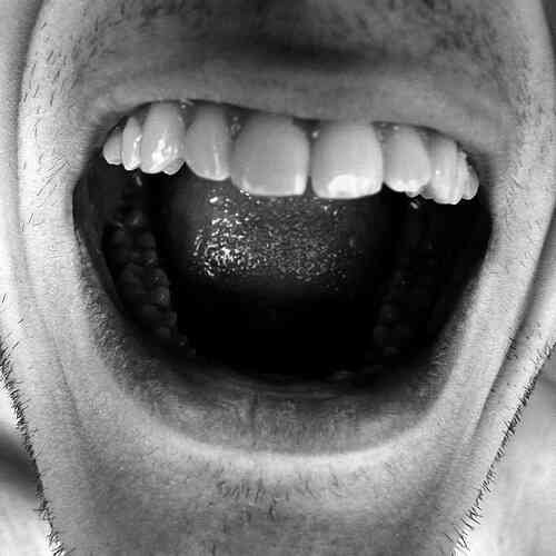 ¿Cuáles Son las Causas de la acidez de la Saliva?