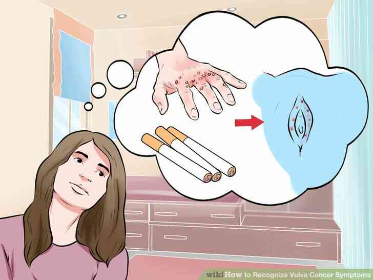 Cómo Reconocer los Síntomas del Cáncer de Vulva