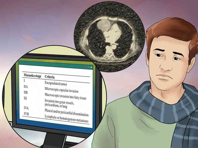 Cómo Diagnosticar un Timoma